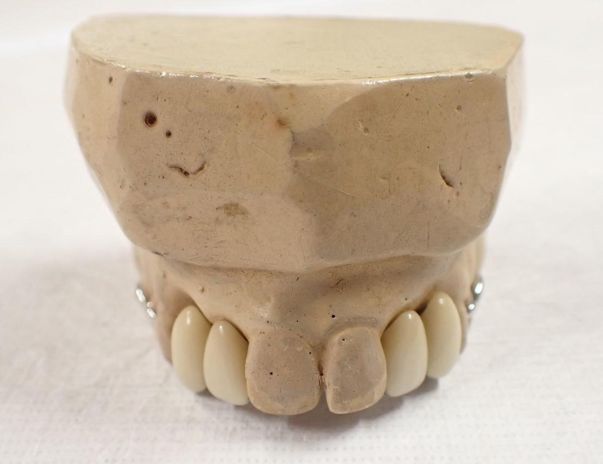 Cast, Upper Teeth with partial denture - Nelson Provincial Museum